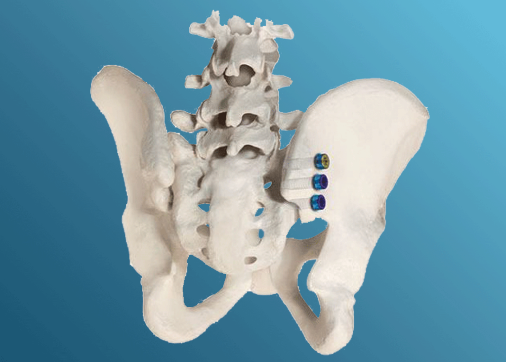 Procedures – Center for Spine Surgery